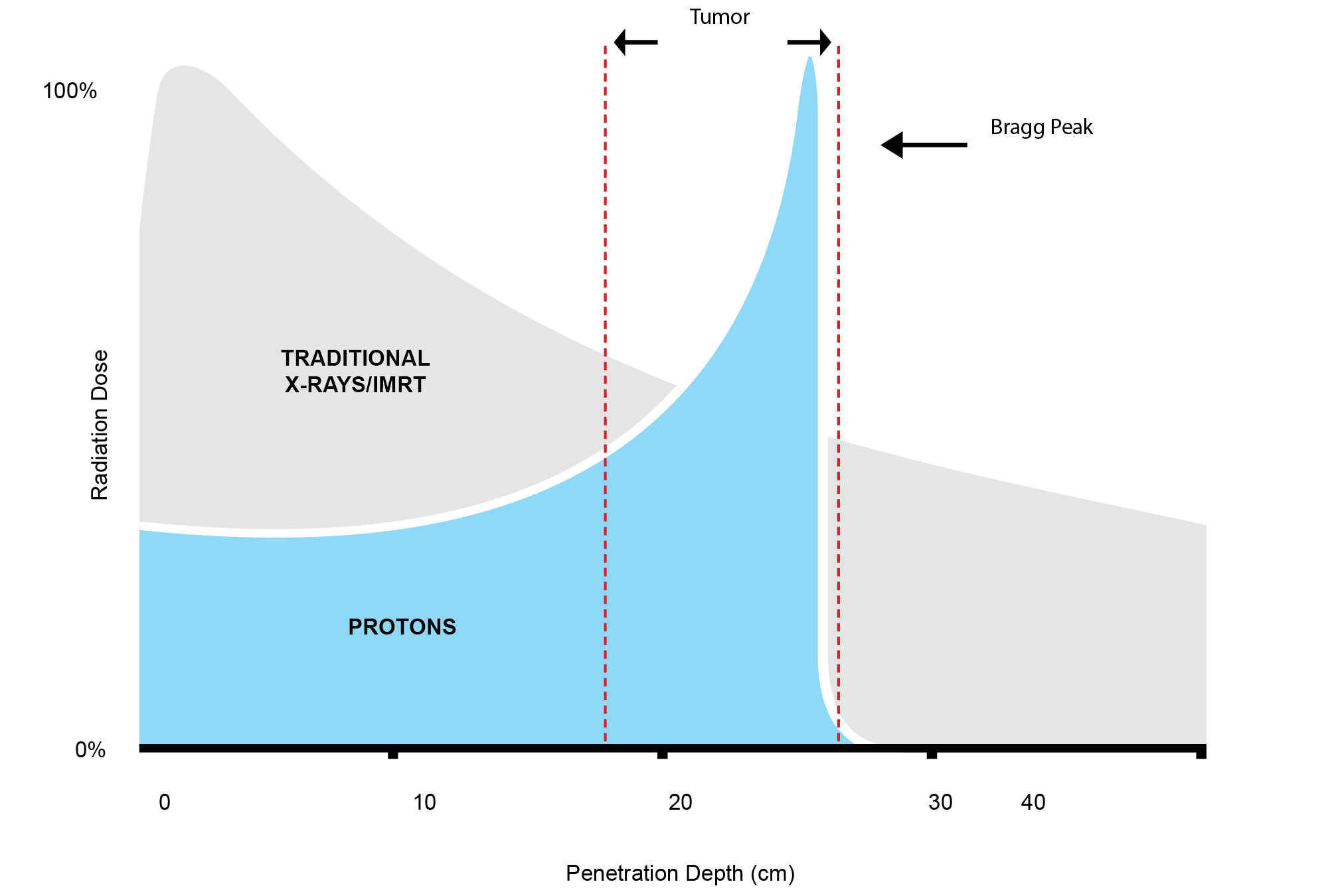 Proton Beam Therapy - Tennessee Oncology Proton Center